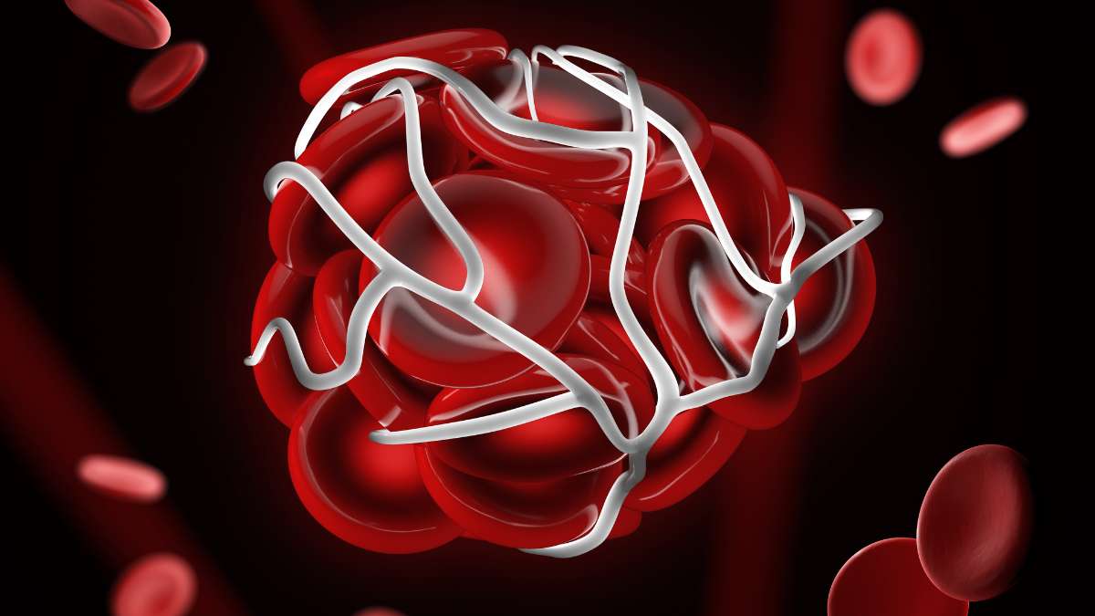 Fibrinogeno cos’è e la conversione in fibrina - UniD Formazione