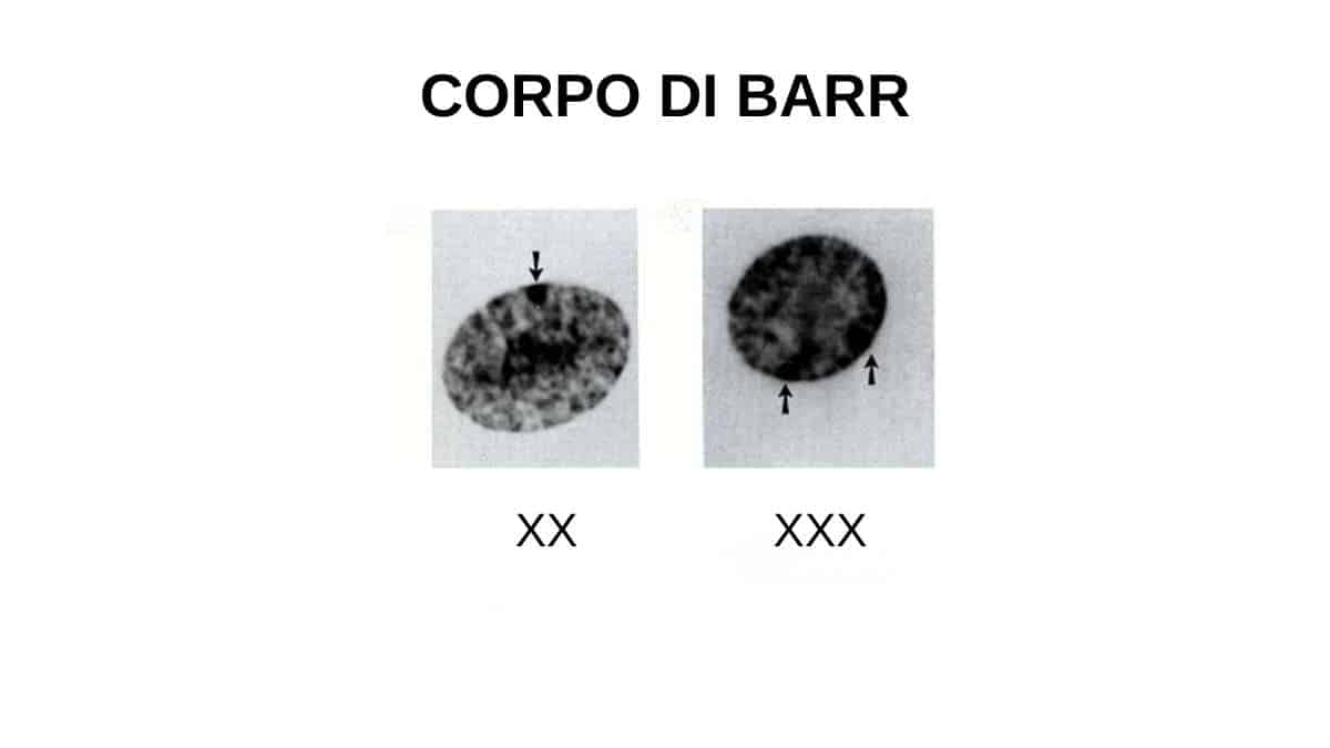 Che cos'è il corpo di Barr e come funziona la sua inattivazione