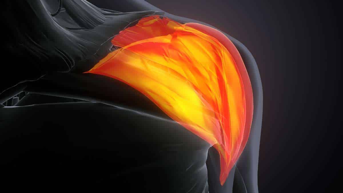 Il muscolo deltoide: struttura, punti di inserzione e funzioni